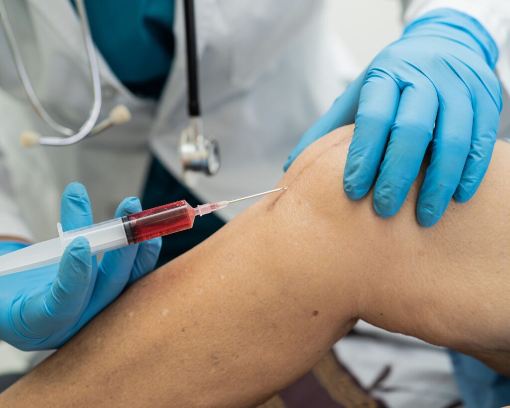 PRP Training for Joints & Tendon – PRP Pure (Platelet Rich Plasma ...